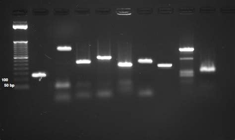 Pcr Amplification For Detection Of Staphylococcus Aureus Genes Line 1 Download Scientific