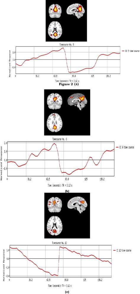 activation pattern with activation time course in posterior cingulate