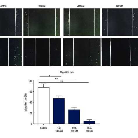 Wound Healing Assay Of Huvec Treated With Different Concentrations Of