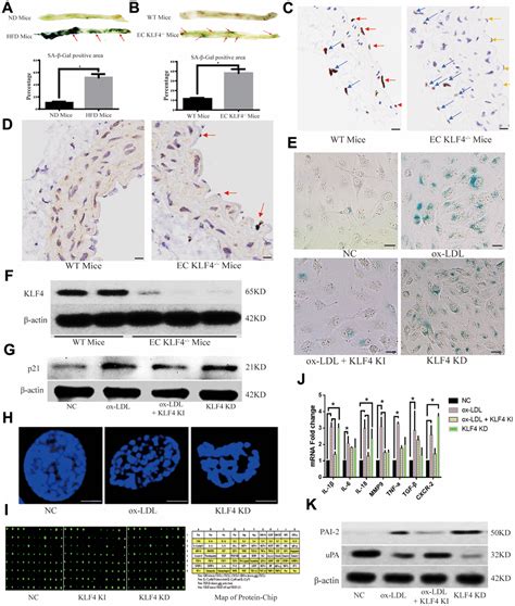 Klf4 Inhibited The Senescence Associated Secretory Phenotype In Ox Ldl
