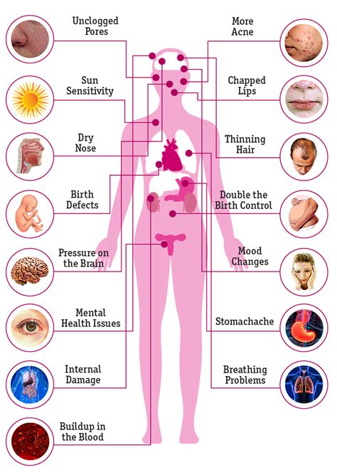 Accutane What Are The Side Effects On The Body Accutane Best Acne