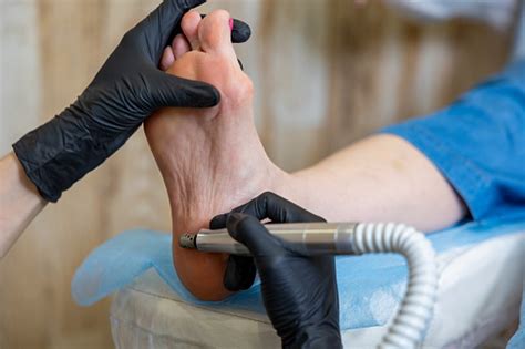 발과 페디큐어를 벗겨내는 전문 장치 주인은 미용실에서 페디큐어를합니다 각질화 균열 옥수수 및 굳은 살 제거 페디큐어 네일 케어의