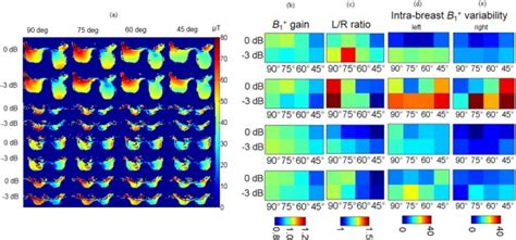 Rf Shimming In Vivo Results Distribution For Different Shim Download Scientific Diagram