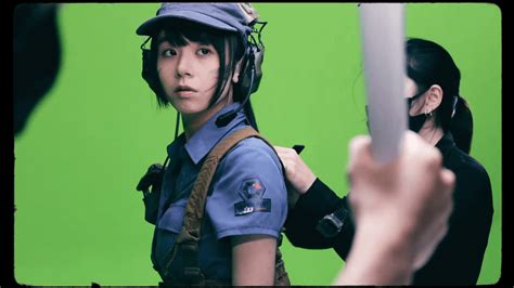 Brace Up Pictures R 163braces