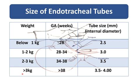 Endotracheal Tube Size Chart