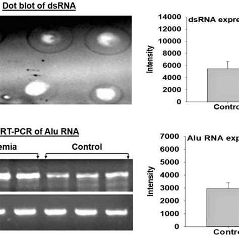 Expression Of Dsrna And Alu Rna A Shows A Dot Blot Sample Of Dsrna Download Scientific