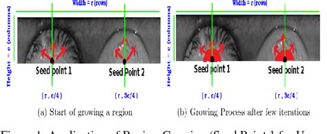 Figure 1 From Iris Recognition Using Block Local Binary Patterns And