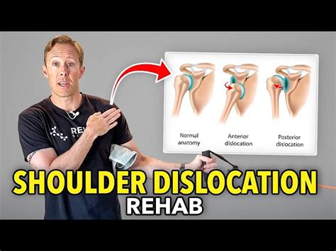 Shoulder Dislocation Exercises