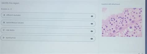 Solved Identify This Region Question Attachment Chegg Com