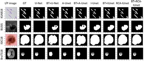 Bt Unet A Self Supervised Learning Framework For Biomedical Image Segmentation Using Barlow