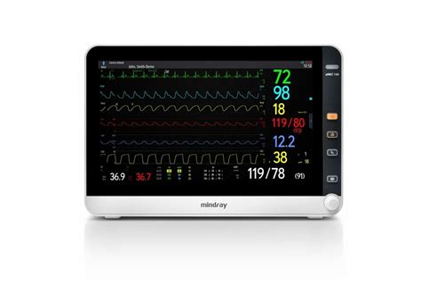 Mindray Umec 100 Patient Monitor 10 4 Inch At ₹ 78000 In New Delhi Id 2854043801055