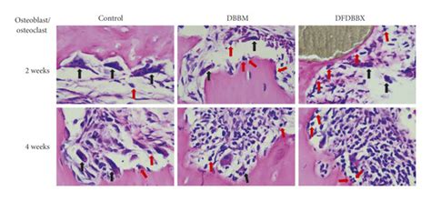 The Osteoblast Osteoclast Quantification A Microscope View Of Defect