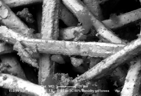 How Can I Do Particle Analysis For Such Pictures As This Researchgate