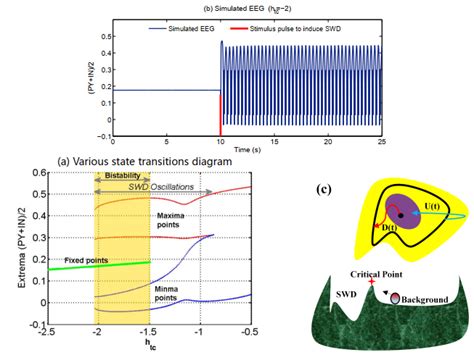 The Preview Control Of A Corticothalamic Model With Disturbance