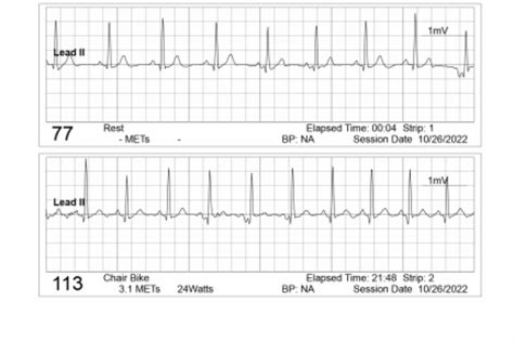 What Is This Rhythm R Readmyecg