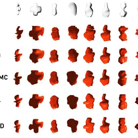 Pdf Gan‐lstm‐3d An Efficient Method For Lung Tumour 3d Reconstruction Enhanced By Attention