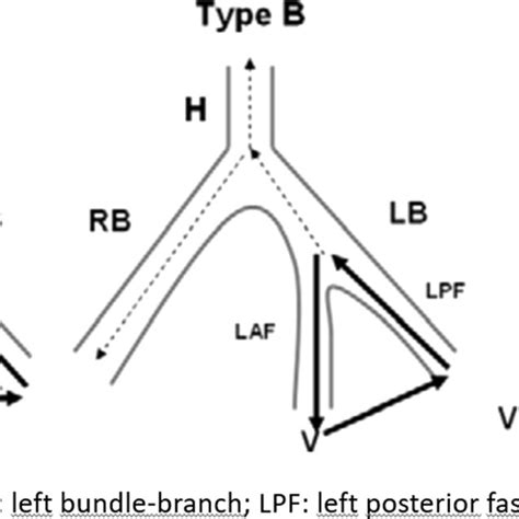A Schematic Diagram Showing The Circuits In 3 Types Of Bundle Branch Download Scientific