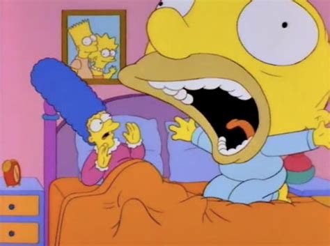 Spotlight On Sleep Disorders Exploding Head Syndrome Thoracic And Sleep Group Queensland