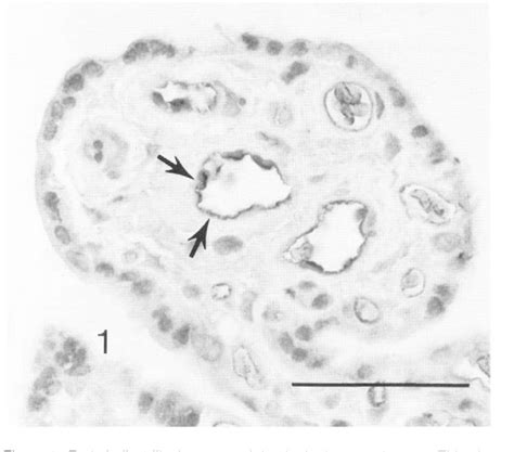 Figure 1 From Localization Of Endothelin 1 Like Immunoreactivity In