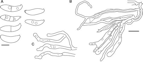 Dendrodacrys Brasiliense Micromorphology A Basidiospores B Basidia Download Scientific