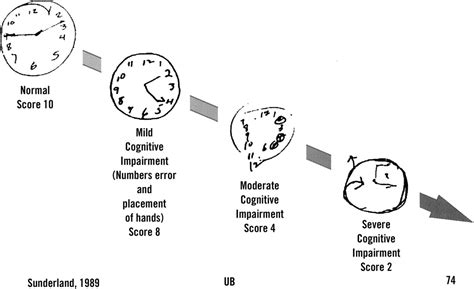 Moca Memory Test Scoring Of 17 Rolfreach