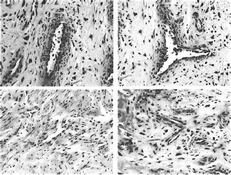 9 Oral Doxycycline Reduced Inflammation In Chronic Pressure Ulcer Top Download Scientific