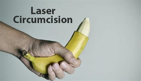 Post Procedure Care Smooth Laser Circumcision Recovery Tips