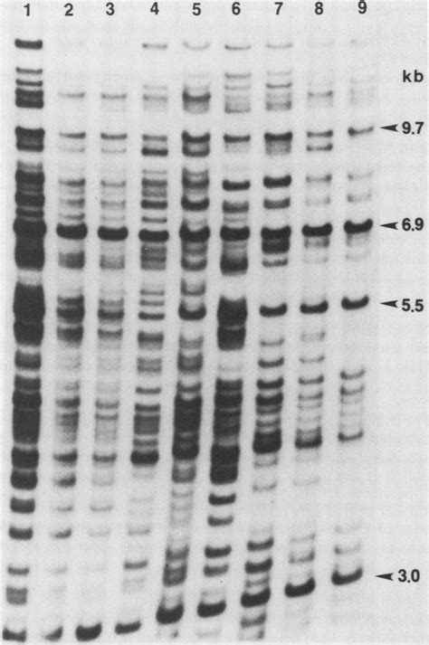 Conservation Of N Myc Amplification Units Labeled Ngp Hindiii Dna Download Scientific Diagram