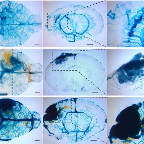Timing Of Brain Avm Development After Stereotaxic Intracerebral Download Scientific Diagram
