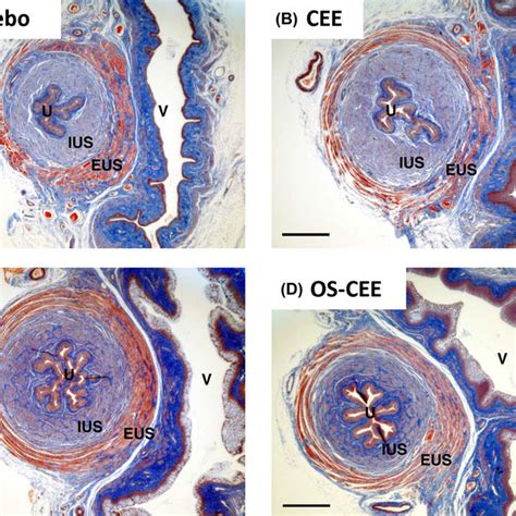 Histologic Effects On Vaginal Epithelium A Quantification Of