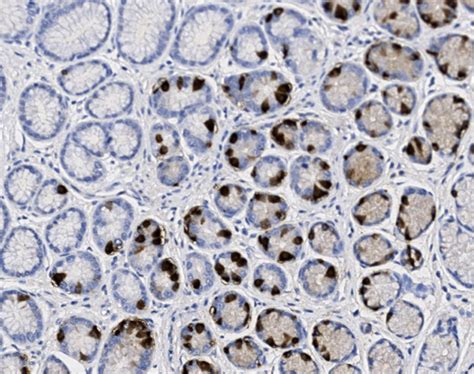 Tissue Tek Genie Rapid True Random Access Ihc Staining