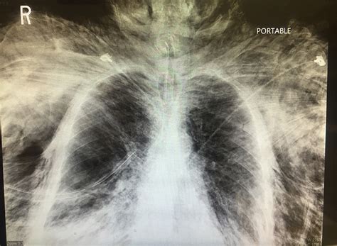 Photo Of The Week Archive Emergency Medicine Blog Drexel University College Of Medicine