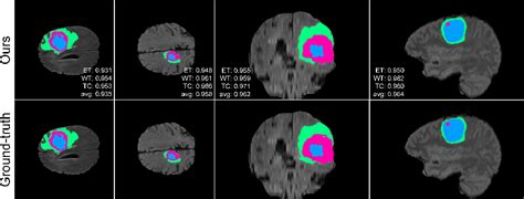 Figure 8 From Cross Modality Deep Feature Learning For Brain Tumor Segmentation Semantic Scholar
