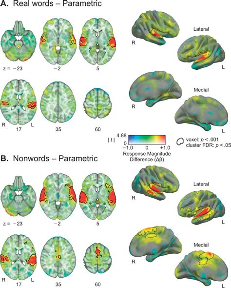Parametric Modulation Of Brain Response With Increasing Phonological Download Scientific
