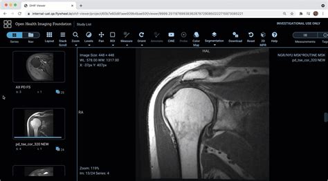view and annotate images flywheel documentation