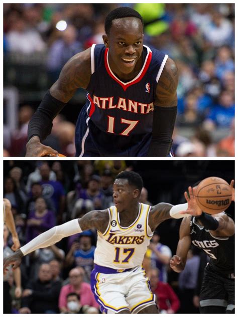 Dennis Schroeder Haarlijn Dennis Schroder Hair Transplsnt Tiktok