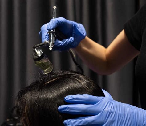 Non Invasive And Intense Scalp Treatment In Singapore Tricholab