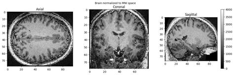 Basic Nipype Example — Neurodesk