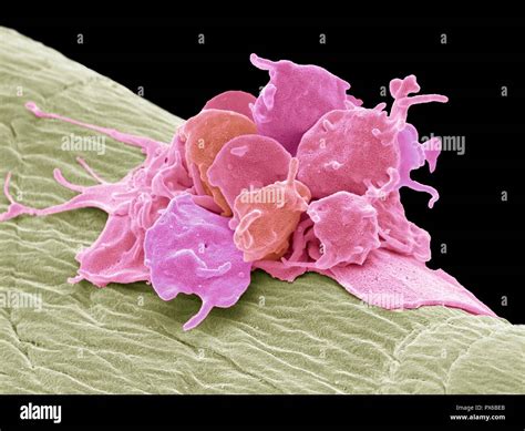 Activated Platelets Coloured Scanning Electron Micrograph Sem Of Activated Platelets Attached