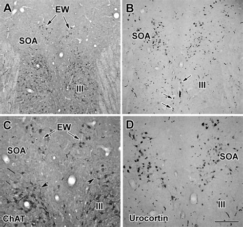 Low Ab And High Cd Magnification Views Of The Labeling Of