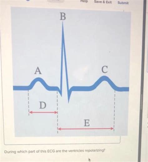 Solved Help Save And Exit Submit B A С D E During Which Part