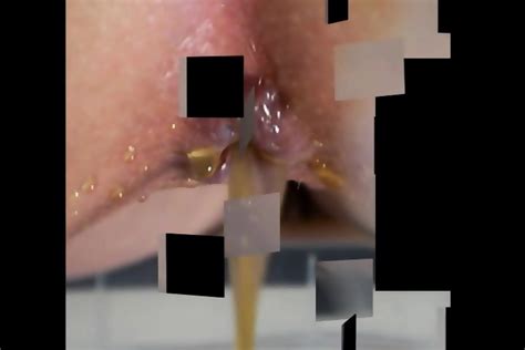 Colon Cleansing With Suppositories And Enemas Eporner