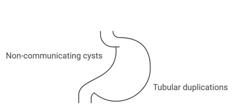 What Causes Abdominal Cysts A Look Into Risk Factors Surgery For