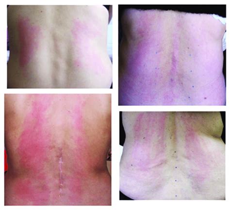 Examples Of Asymmetry Download Scientific Diagram