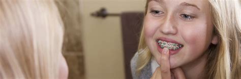 Bracket On Braces Loose At Henry Briggs Blog