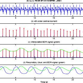 Different Steps For Estimating The EDR Signal Download Scientific Diagram