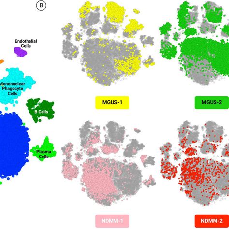 bone marrow tumor microenvironment landscape across mm stages