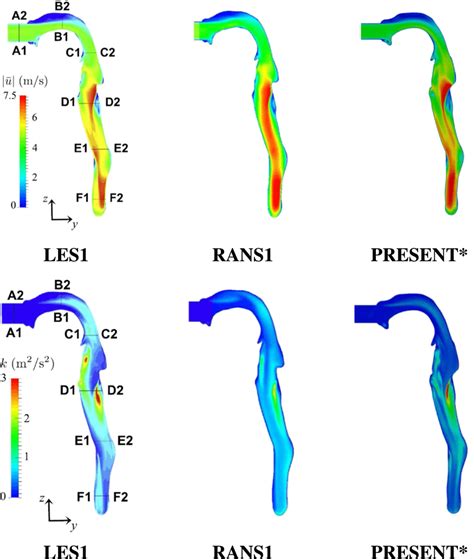 Velocity Profile And Turbulent Kinetic Energy In The Central Sagittal Download Scientific