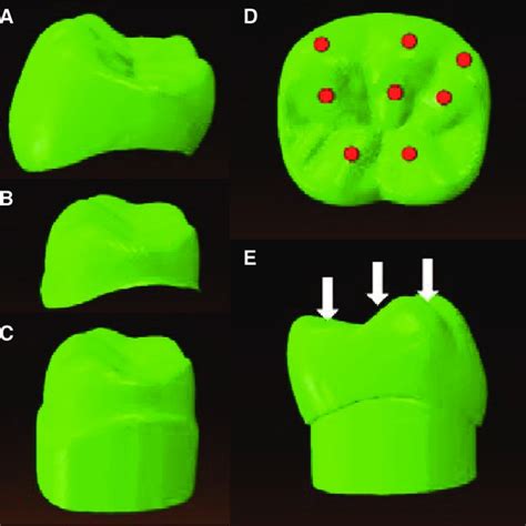 Three Components Of The Finite Element Analysis Model A Monolithic