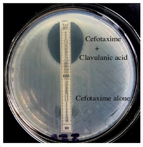 Esbl E Strip Test For Confirmation Of Esbl Producing E Coli And Download Scientific Diagram